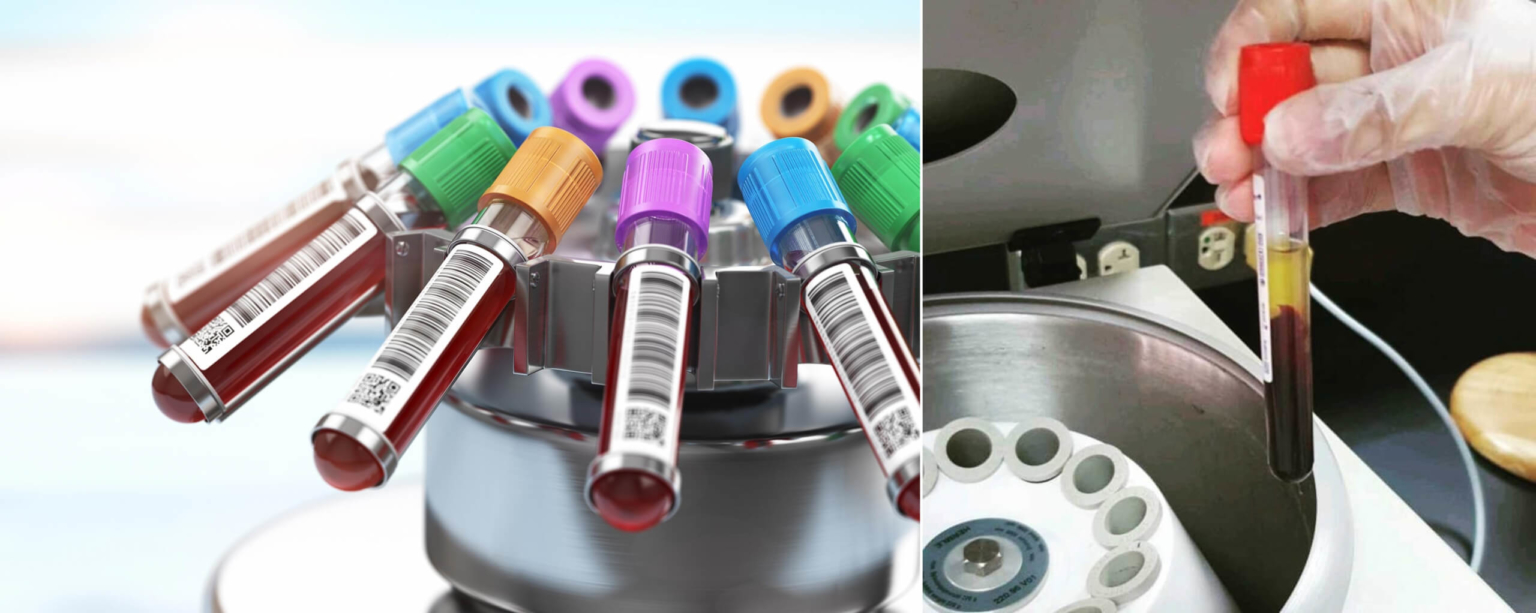 Reliable Blood Serum Centrifuge Machine Manufacturers China